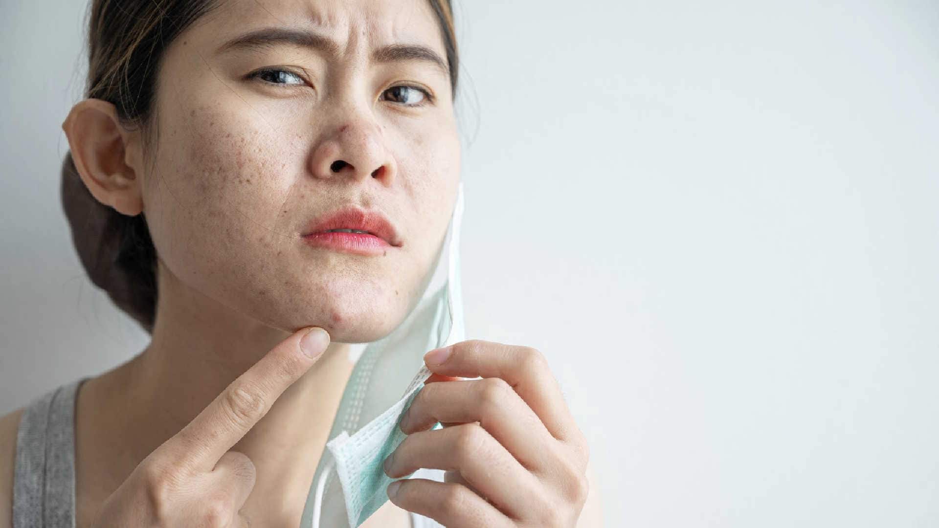 Adverse Effects of Prolonged Mask Use