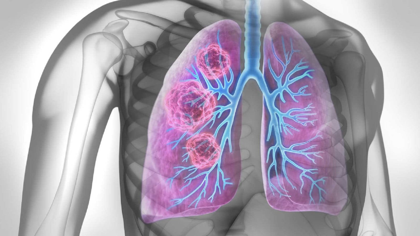 Dangers of Breathing in MicroPlastics found in MASKS